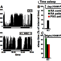 Actigram of a child before treatment.