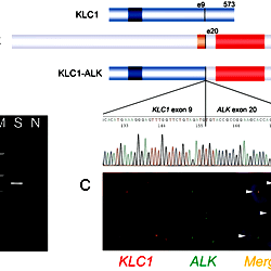 Identification of KLC1-ALK.