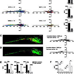 Differentiation between poorly and highly aggressive human cancer cell ...