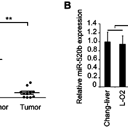 MiR-520b is downregulated in HCC tissues and hepatoma cell lines.