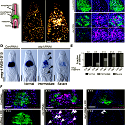 cbp1(RNAi) results in degeneration of the esophageal glands.