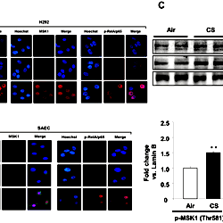 Cigarette smoke increased p-MSK1 (Thr581) and p-RelA/p65 (Ser276) in ...