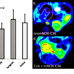 Dynamic Contrast Enhanced–MRI.
