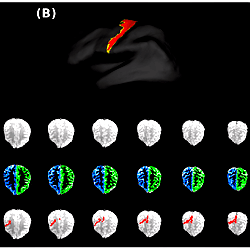 BA4 labelling and registration to the functional space.