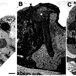 Deiters' cell migration.