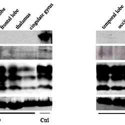Analyses of the levels of MAP2 in the brain tissues of human prion ...
