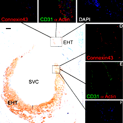 Cardiac morphology of EHT-conduit 28 days after grafting.