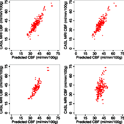 pCASL MRI CBF data versus predicted CBF.