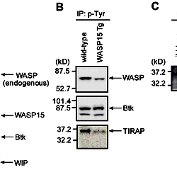 Complex formation of WIP-WASP-Btk and phosphorylation of WASP and TIRAP ...
