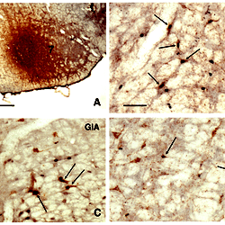 Fos/CTb labeling in the PS recovery condition after injection of CTb in ...