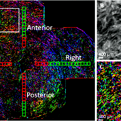 A pixel-wise directionality map on an en face image parallel from and ...