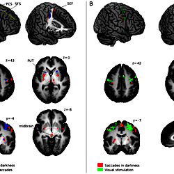 Group activation maps.