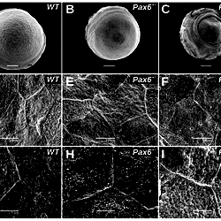 Electron microscopy of whole eyes and corneal epithelium.