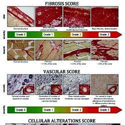 Scale of severity for inflammation, fibrosis, vascularity and cellular ...