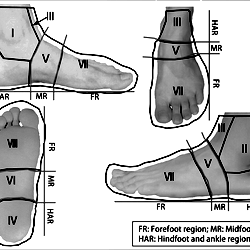 The eight subunits (I-VIII) within three regions (forefoot, midfoot ...