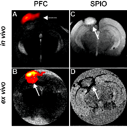 In vivo and ex vivo19F and SPIO-enhanced MRI in late stages of infarct ...