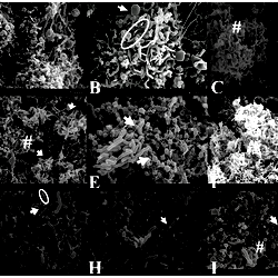 Scanning electron microscopy of human mucin producing intestinal cell ...