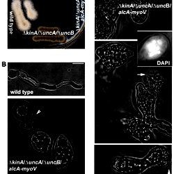 The ΔkinA/ΔuncA/ΔuncB/alcA-myoV quadruple mutant exhibits a severe ...
