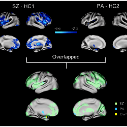 Surface renderings representing the results from the analysis of ...