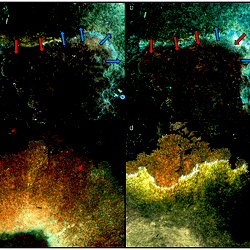 Temporal patterns of white syndrome lesions.