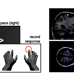 Finger-tapping task: paradigm and classical SPM.
