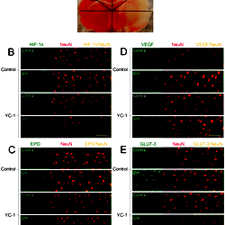 Effect of YC-1 on HIF-1 expression in neurons in ischemic brains.