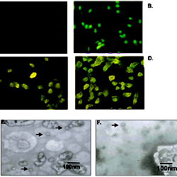 Detection of the FMDV structure protein and FMDV capsid.