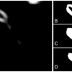 Intermediate steps in the image analysis algorithm.