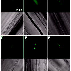 Subcellular distribution of PHYB:YFP and PHYB-401:YFP differs in ...