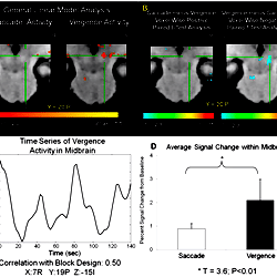 Functional activity within the midbrain using a GLM analysis (Plot A).