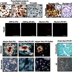 Differentiation of hAEC and their characterization.