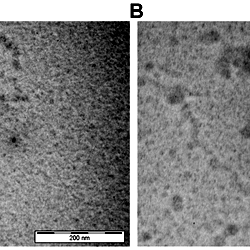 Electron microscopy of soluble chromatin.