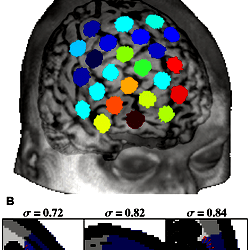 Illustration of gyrification analysis.