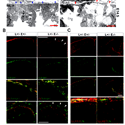 Aberrant RGC structure led to BM destabilization.