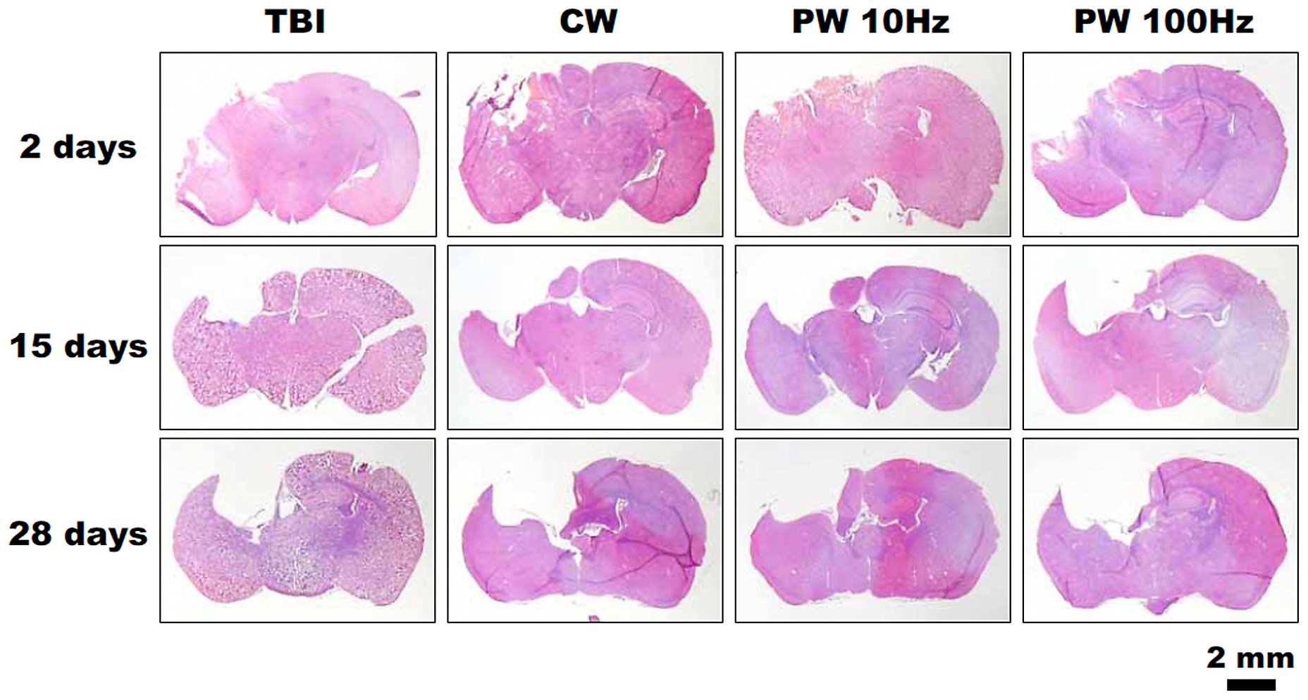 Mouse Hippocampus Histology