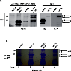 MAP2 and MAP4 are subject to reversible lysine acetylation