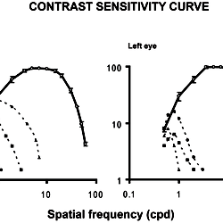 Contrast sensitivity curve.