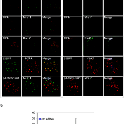 PML is required for irradiation-induced foci of Mre11, BRCA1 and RPA.