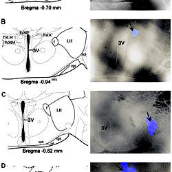 Placement of CTB injections.