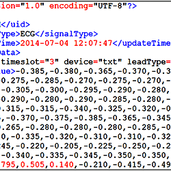 Result of ECG data stored as an XML file.