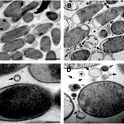 TEM micrographs of ultrathin sections from EcN and EcN tolR strains ...