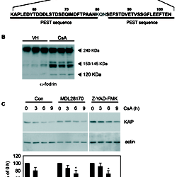 CsA activates calpain and caspases in kidney and cultured proximal ...