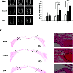 Acceleration of bone regeneration in DNA disk-implanted bony defects.