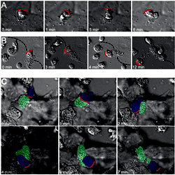 PMN interacts with bacteria bound to epithelial cells.
