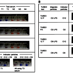 Pictoral results showing efficacy of various TUBEX tests in detecting ...