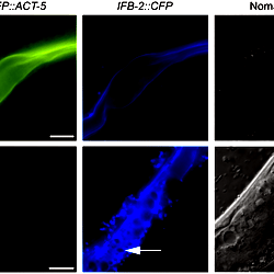 Reducing expression of actin causes terminal web gaps in the absence of ...