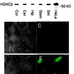 CHD5 protein is expressed in several brain regions.