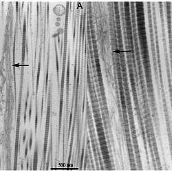 Microfibrils.