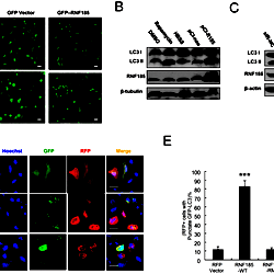 RNF185 regulates autophagy.
