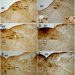 Double immunohistochemical staining of Fos-IR and OTR-IR neurons in the ...